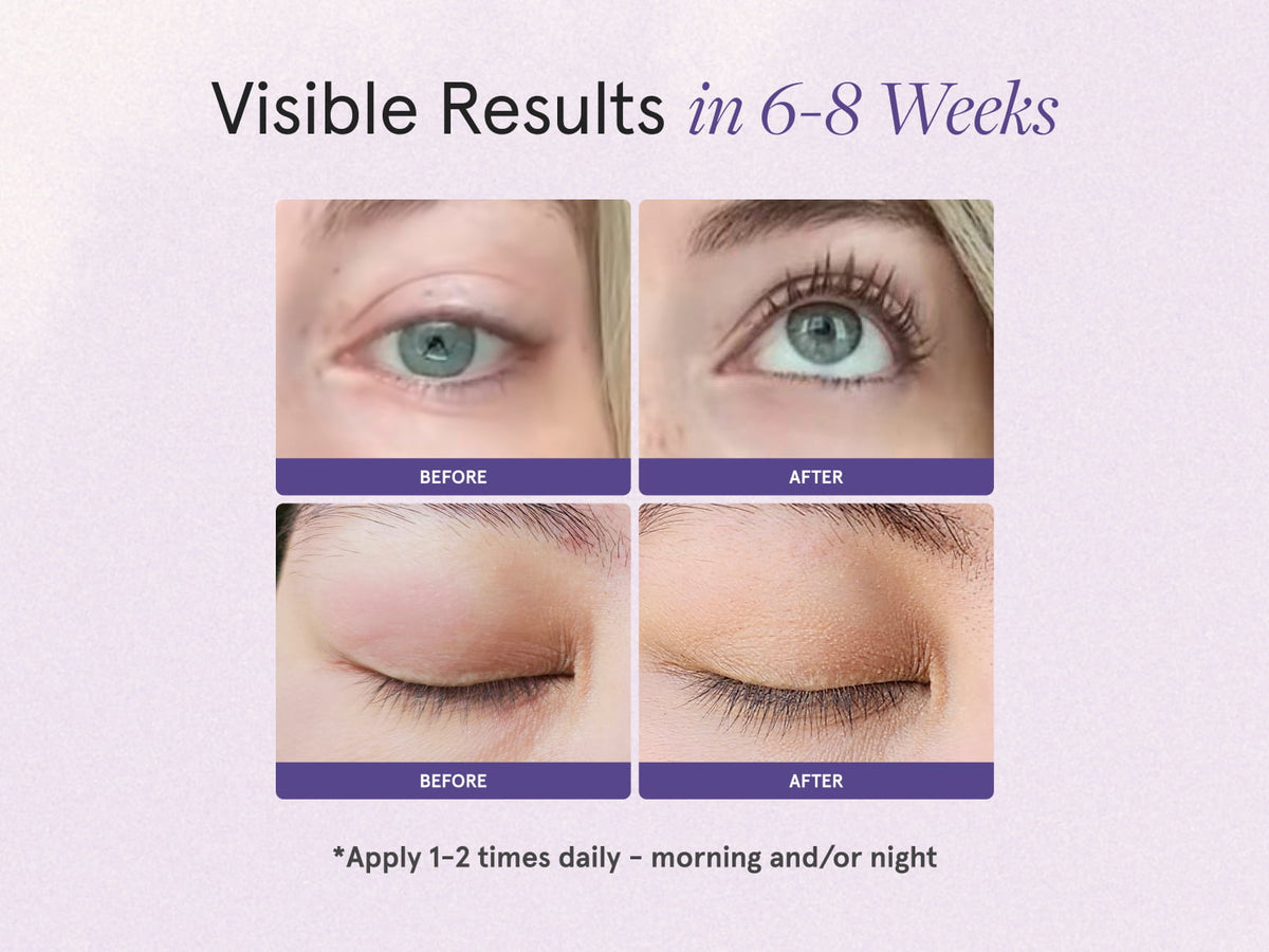 iRESTORE REVIVE Eyelash Enhancing Serum – Transform Your Lashes and ...