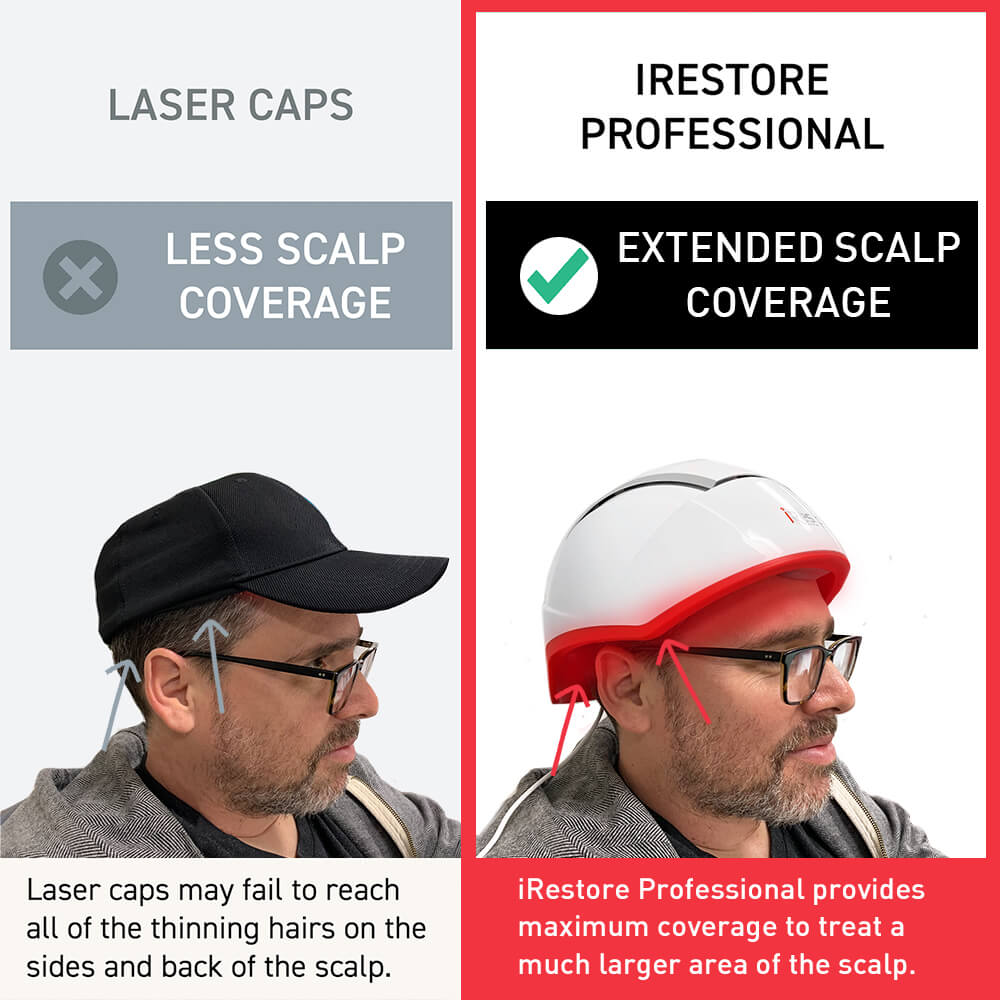 iRestore Professional – Laser Hair Growth System, FDA Cleared ...